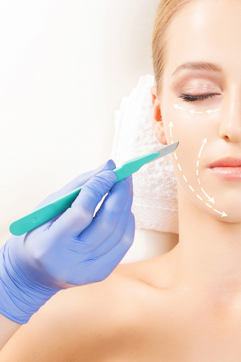 Liposculpture du visage - Dr Maxime Rousié
